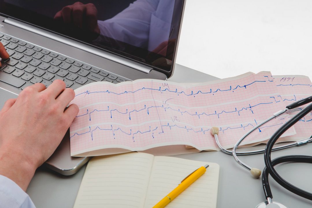 ≡ Extrasystole : Symptômes, Causes et Traitements Possibles