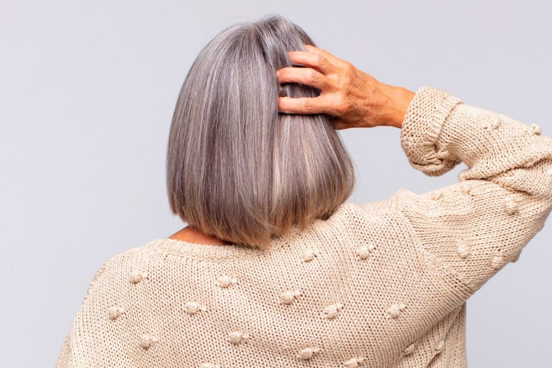 Excès de Sébum : Quels sont les Remèdes Naturels